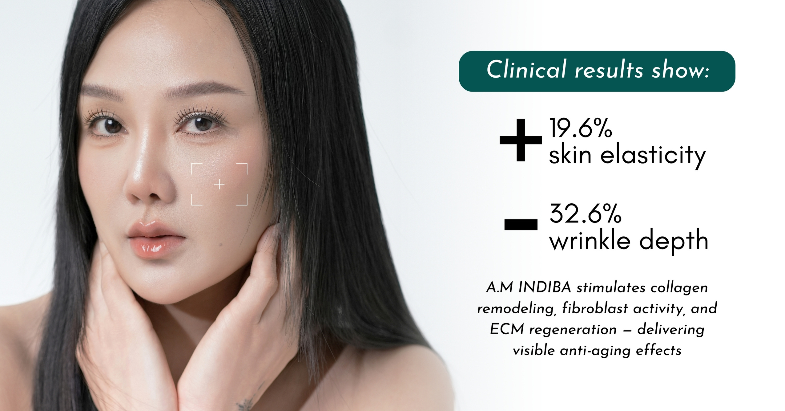 Indiba Treatment: Why More Malaysian Women Are Choosing This Skin Solution